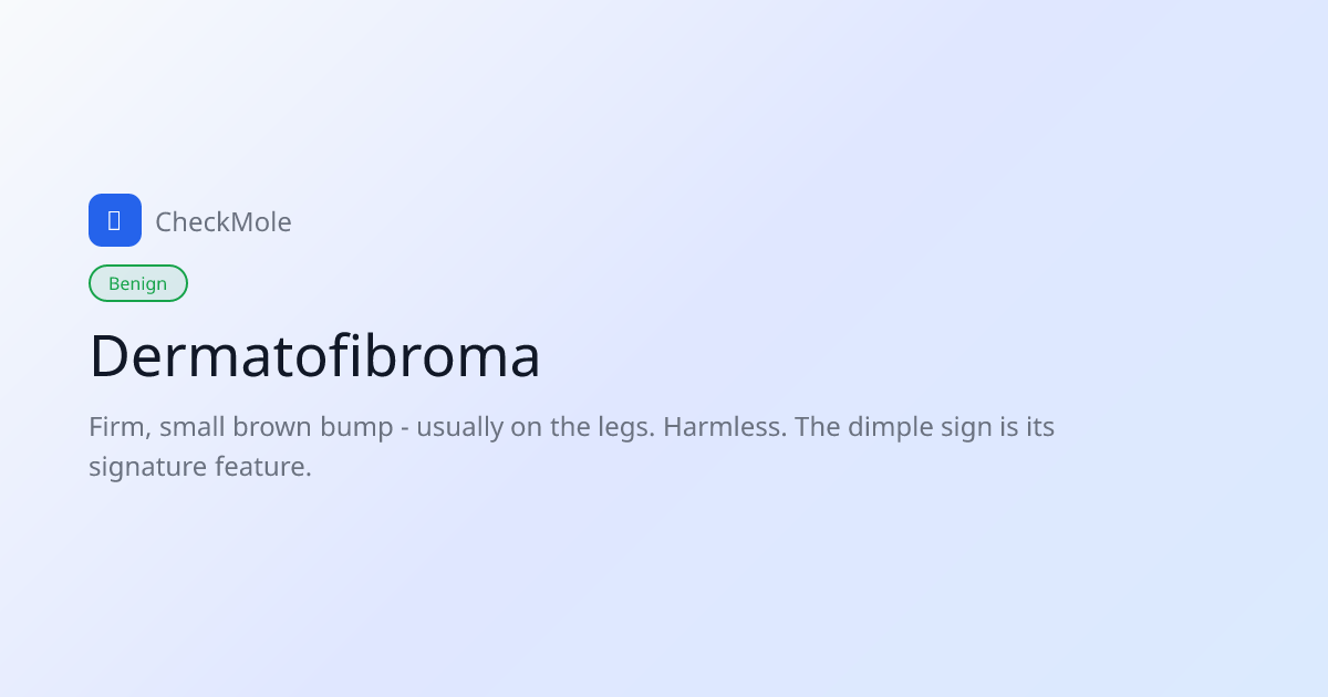 Dermatofibroma: The Dimple Sign & When to Worry - CheckMole