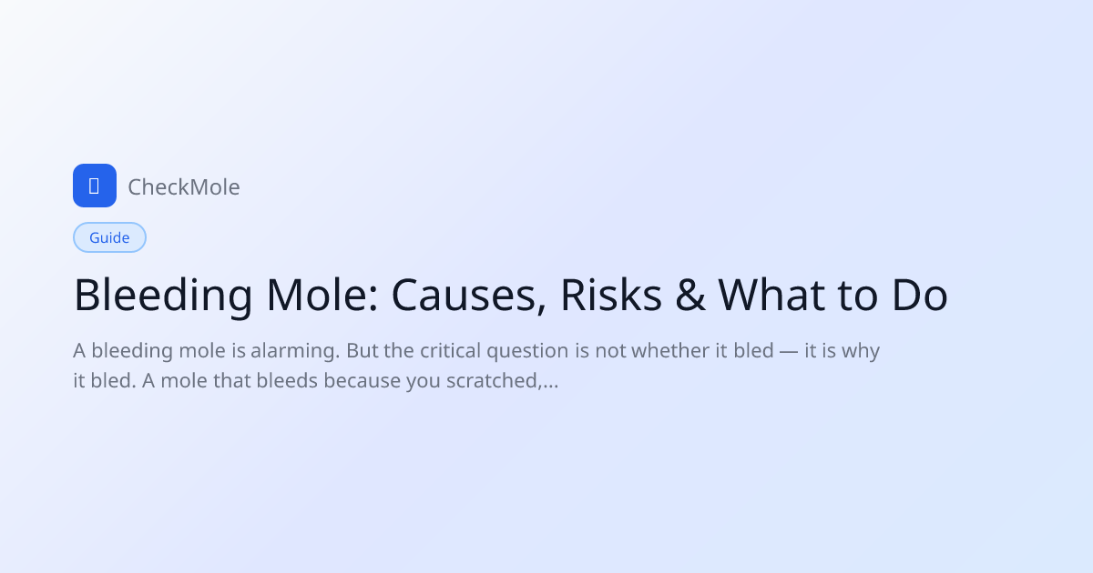 Bleeding Mole: Why It Bleeds, Is It Cancer & What to Do (2026) - CheckMole
